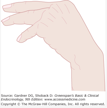 Signs of Hypocalcemia | Medicine Specifics