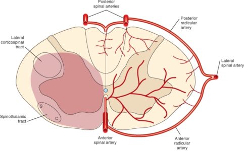 Anterior spinal artery syndrome | Medicine Specifics