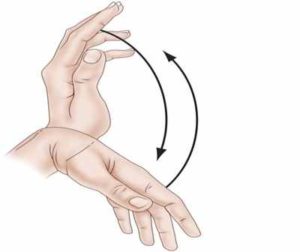 Asterixis: Causes | Medicine Specifics